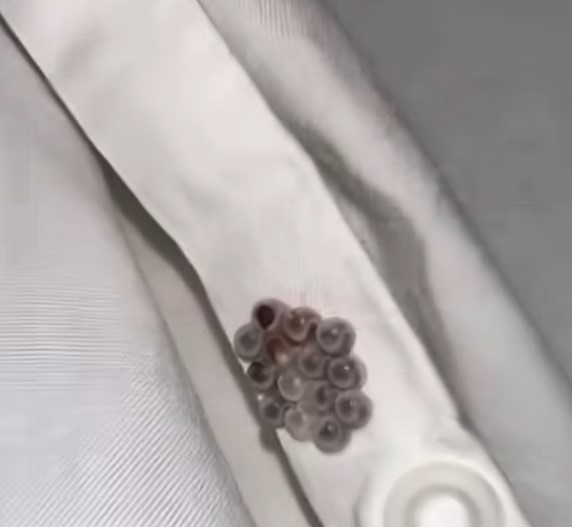 This morning I found small round balls in my bed 😲 When I realized what ...